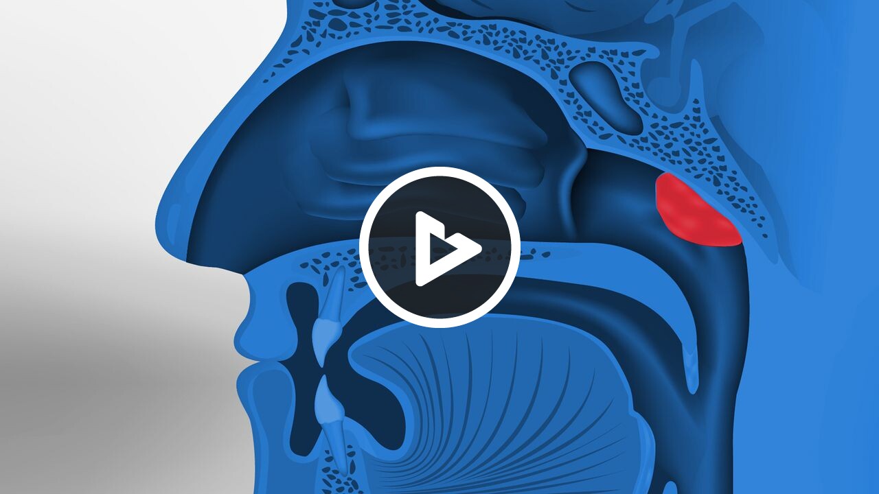 Adenoiditis - ENT Services - Willis Knighton Ear, Nose and Throat and ...